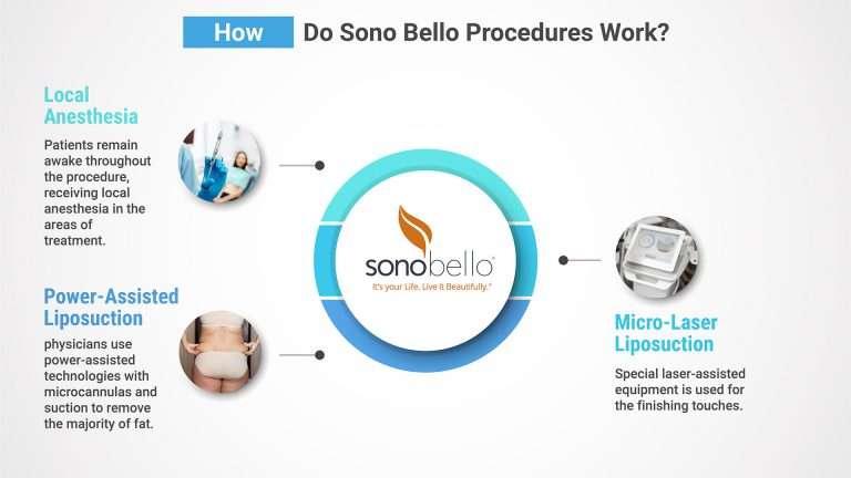 Sono Bello In-depth Review: Truth Exposed - Consumers Compare